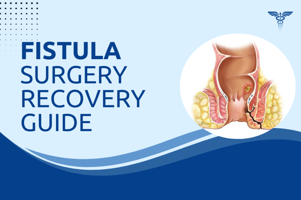 Fistula Surgery Recovery Guide | Dr. Rajeev Premnath