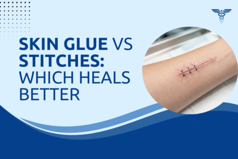 Skin Glue vs Stitches: Which Heals Better | Dr. Rajeev